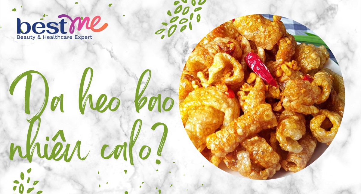 100g da heo bao nhiêu calo? Ăn da heo có tốt không? Có gây mập?