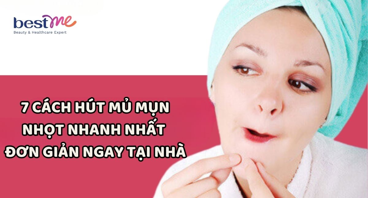 7 cách hút mủ mụn nhọt nhanh nhất đơn giản ngay tại nhà