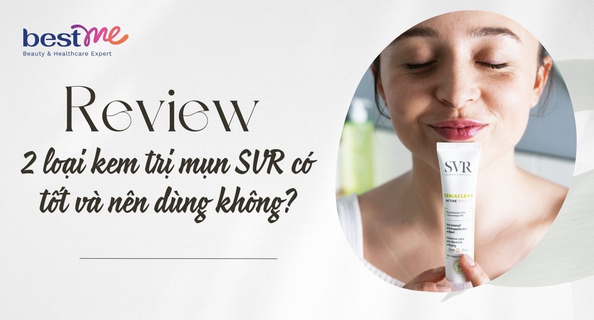 Review 2 loại kem trị mụn SVR có tốt và nên dùng không?