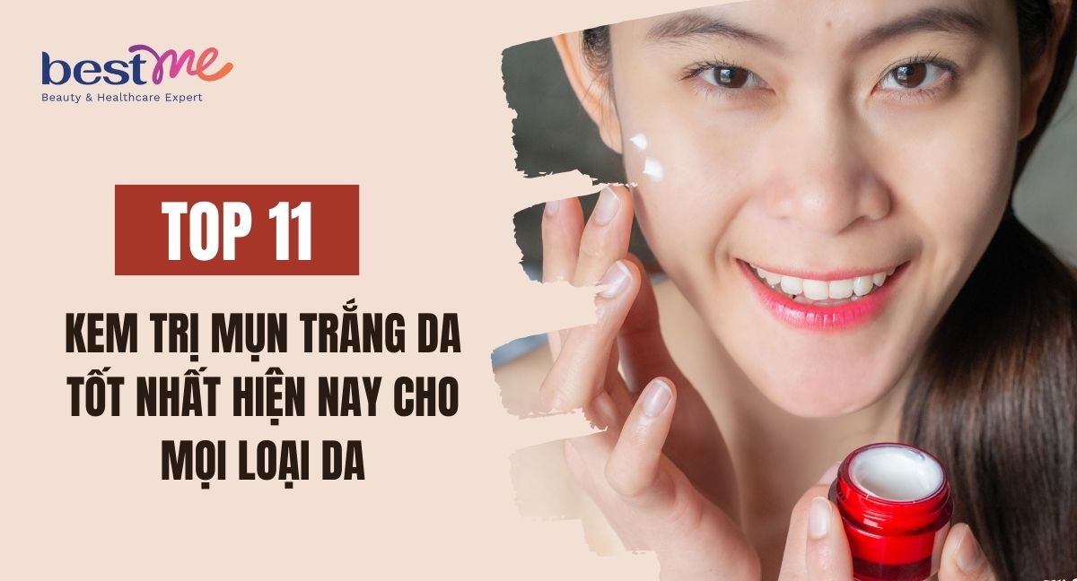TOP 11 kem trị mụn trắng da tốt nhất hiện nay cho mọi loại da