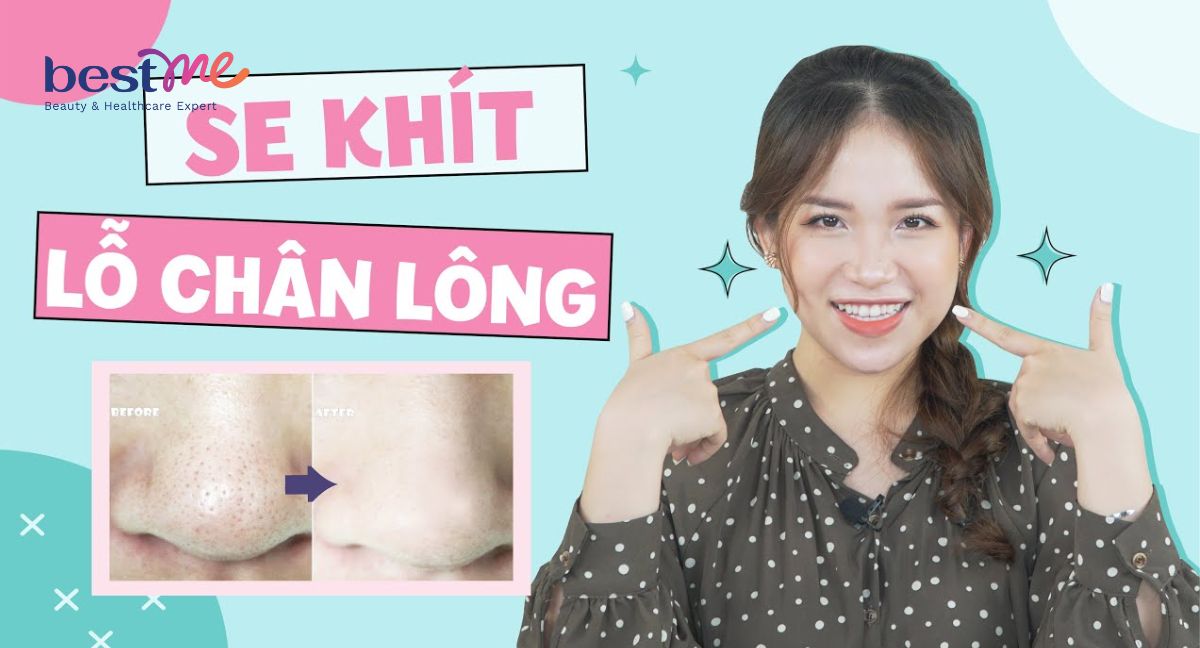 24 cách thu nhỏ, se khít lỗ chân lông ở mặt tại nhà hiệu quả