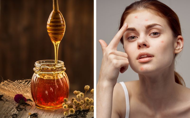 Uống mật ong có nổi mụn không? Bị nổi mụn phải làm sao?