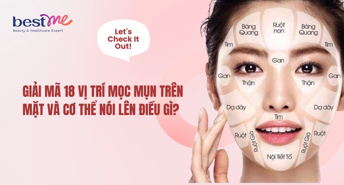 Giải mã 18 vị trí mọc mụn trên mặt và cơ thể nói lên điều gì?